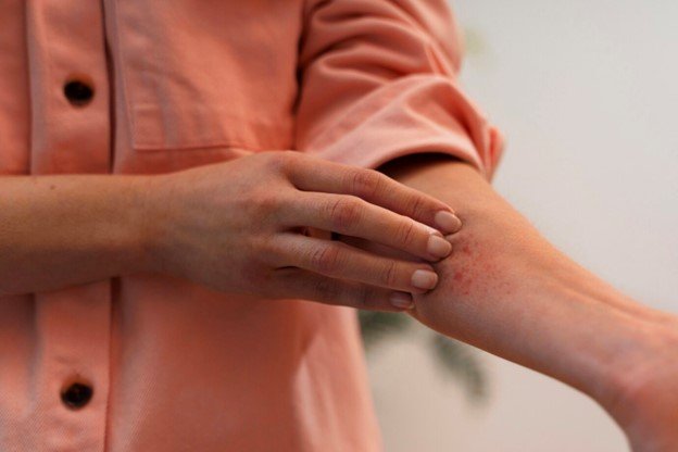 Irritación cutánea: por qué aparece y cómo tratar | La Roche Posay